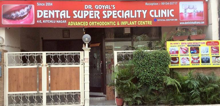 MOST RECOMENDED DENTIST IN LUDDHIANA | DR. GOYAL'S DENTAL CLINIC